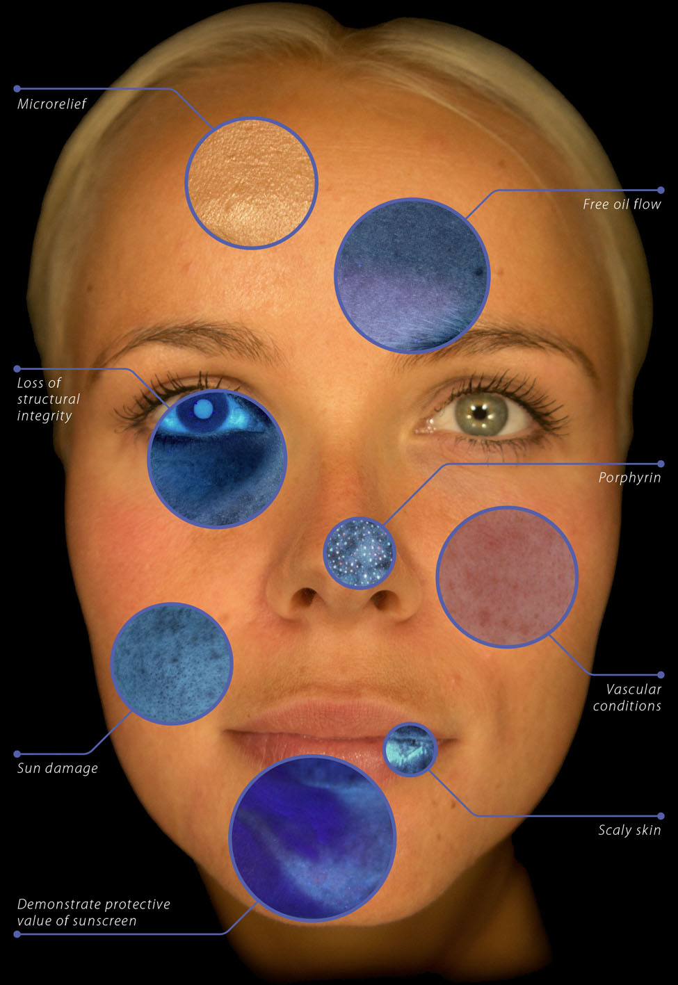 Bespoke Harmony Skin & Treatment Analysis - Harmony Medical Aesthetics ...